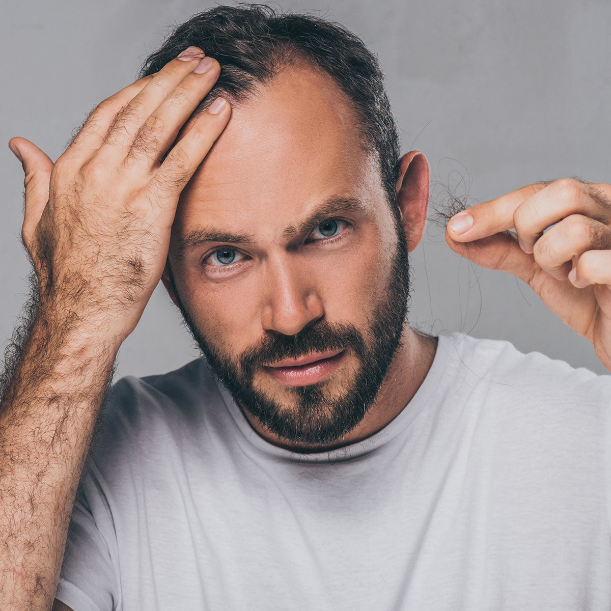 Understanding Minoxidil: What Is It? UK | FOLIGAIN UNITED KINGDOM